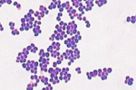 Niveau 2. Gramkleuring van bacteriën