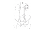 Die Anatomie der Harnorgane